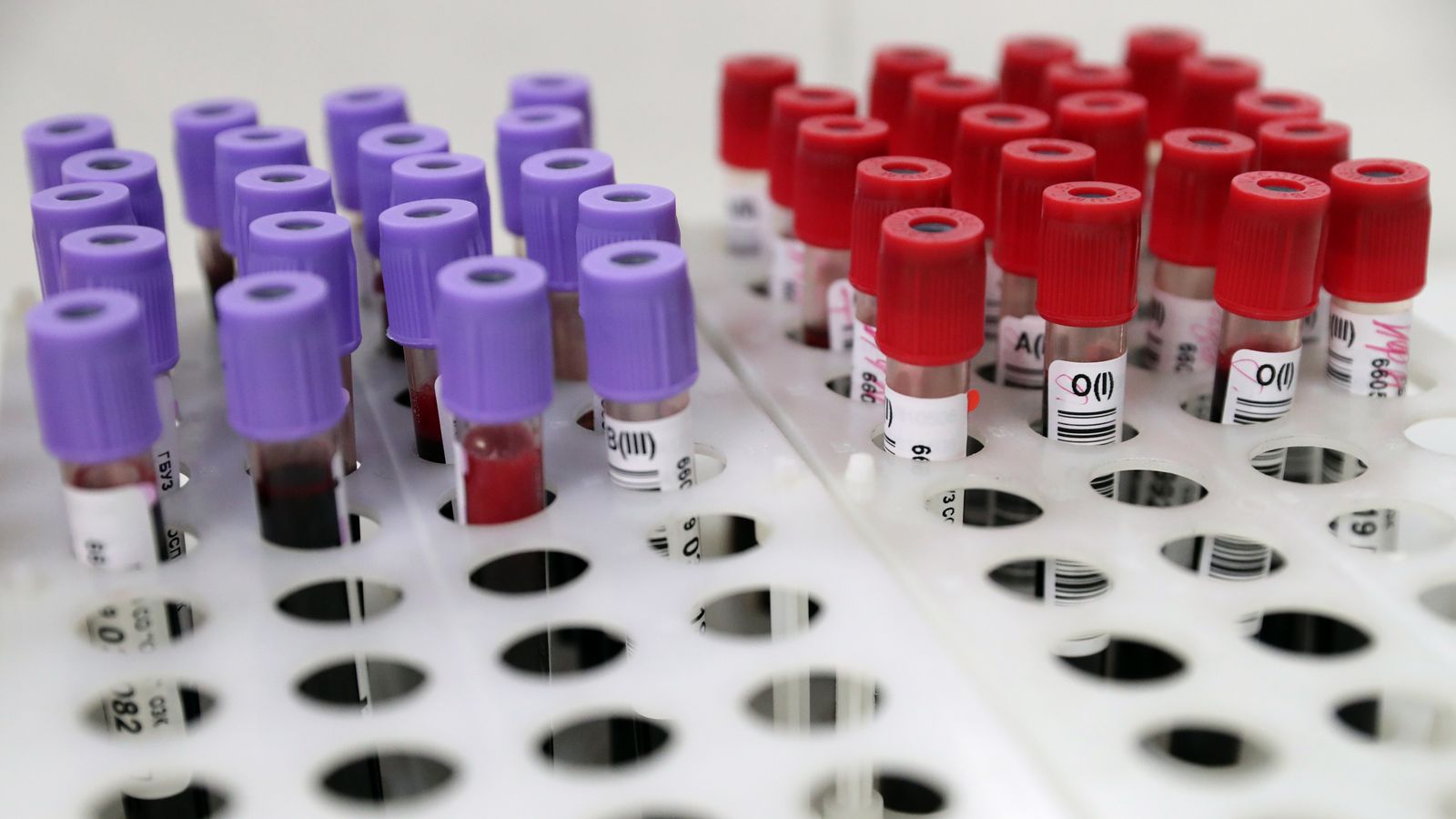 Softbank leads $165 million round for blood testing company Karius