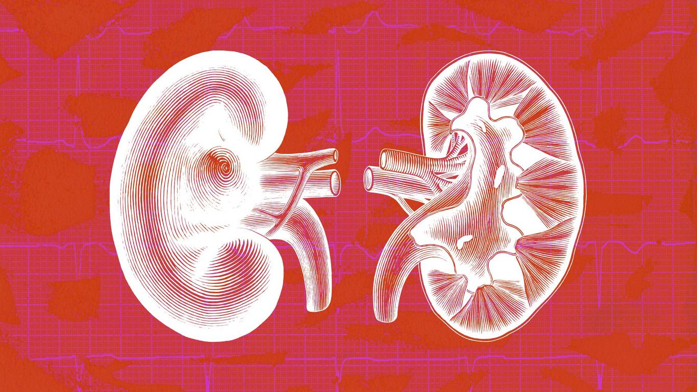 Vertex agrees to pay $4.9 billion for kidney disease drugmaker