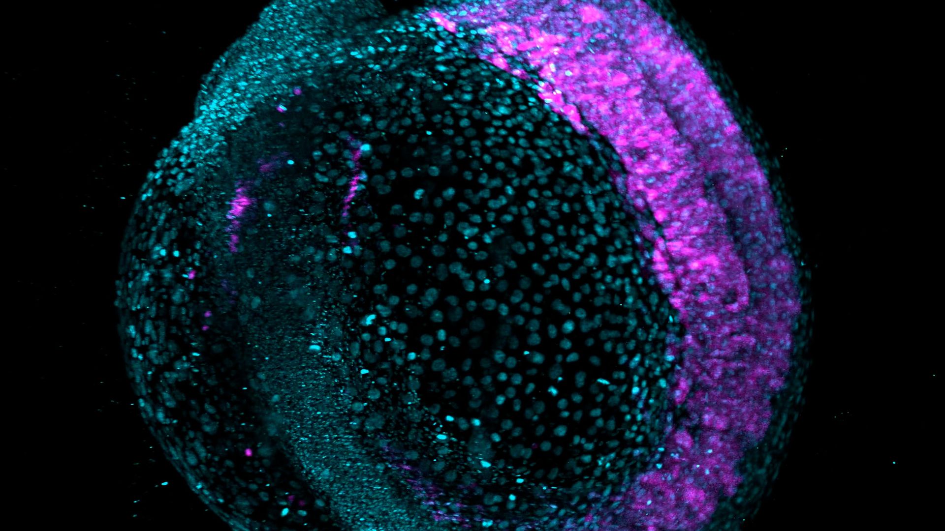 New Chan Zuckerberg biohub to focus on cells' inner workings