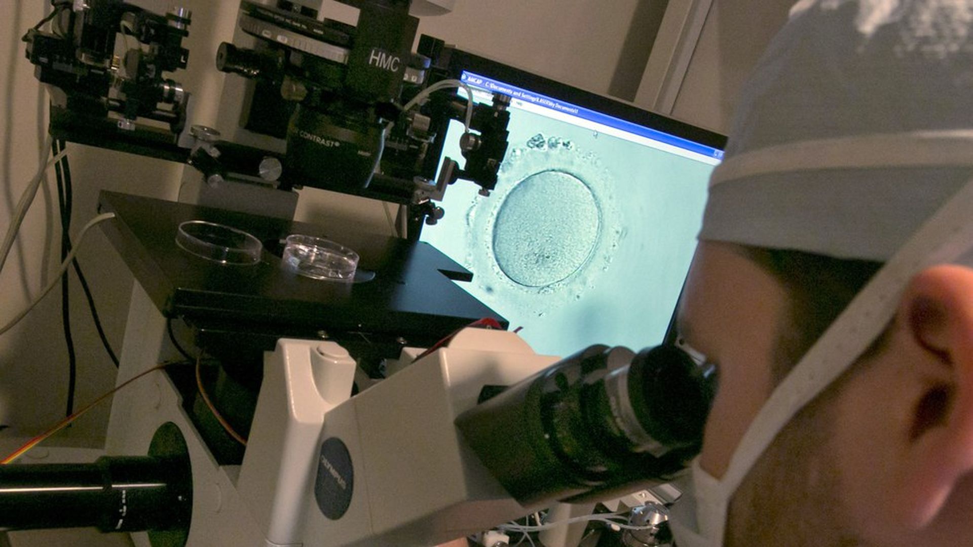 New Western Worry Declining Sperm Counts