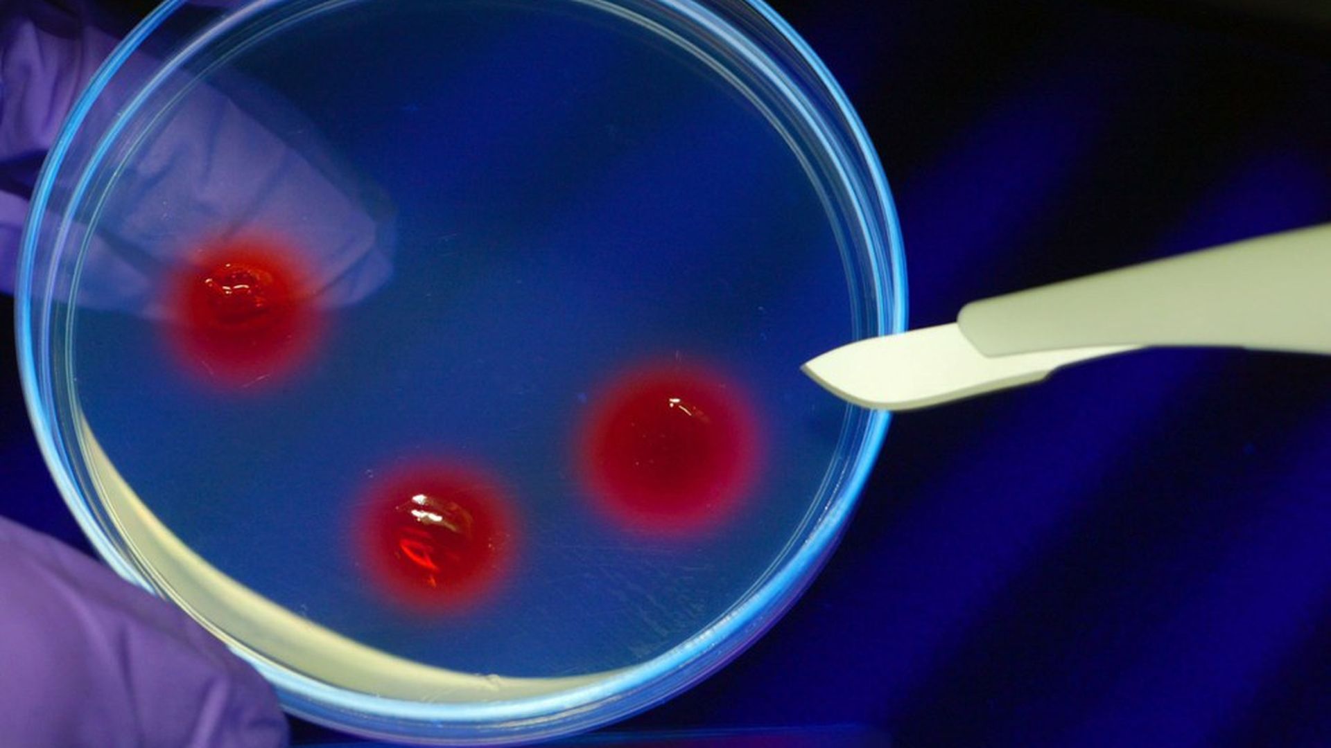 FDA panel recommends leukemia gene therapy for approval