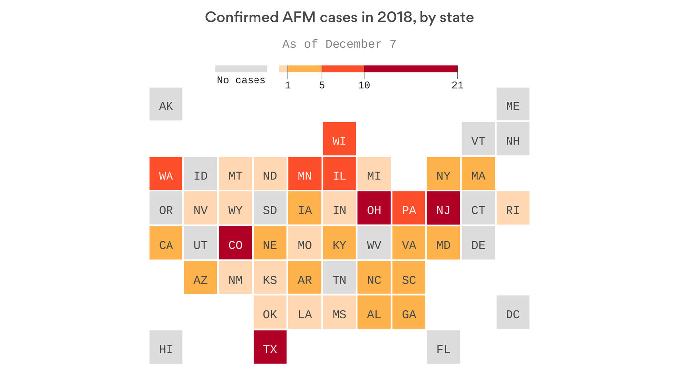 Hunting down the cause of AFM