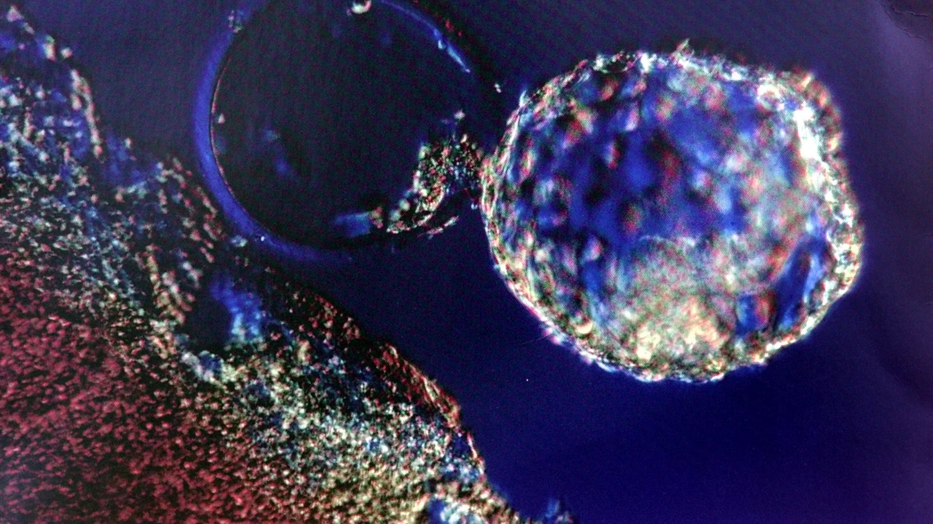 Adriel Bettelheim - Axios