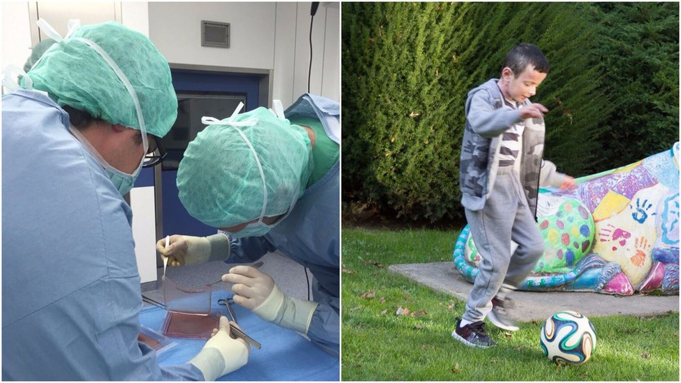 Scientists successfully grow entirely new skin for 7-year-old