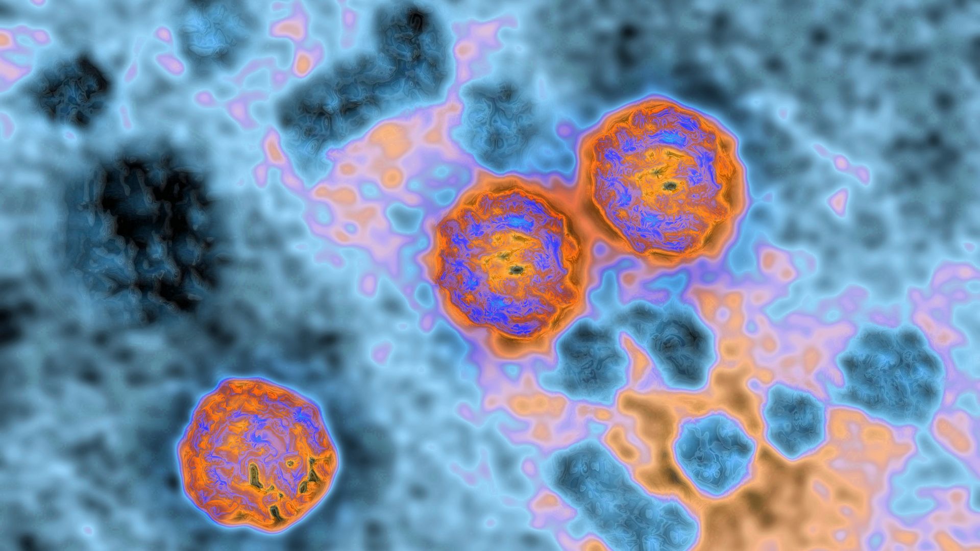 Seattle biotech takes aim at hepatitis B - Axios Seattle