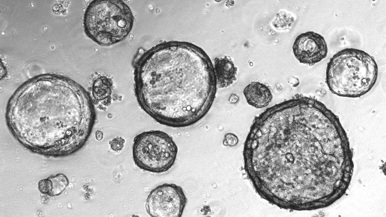 Mini lab-created organs successfully check cancer treatments