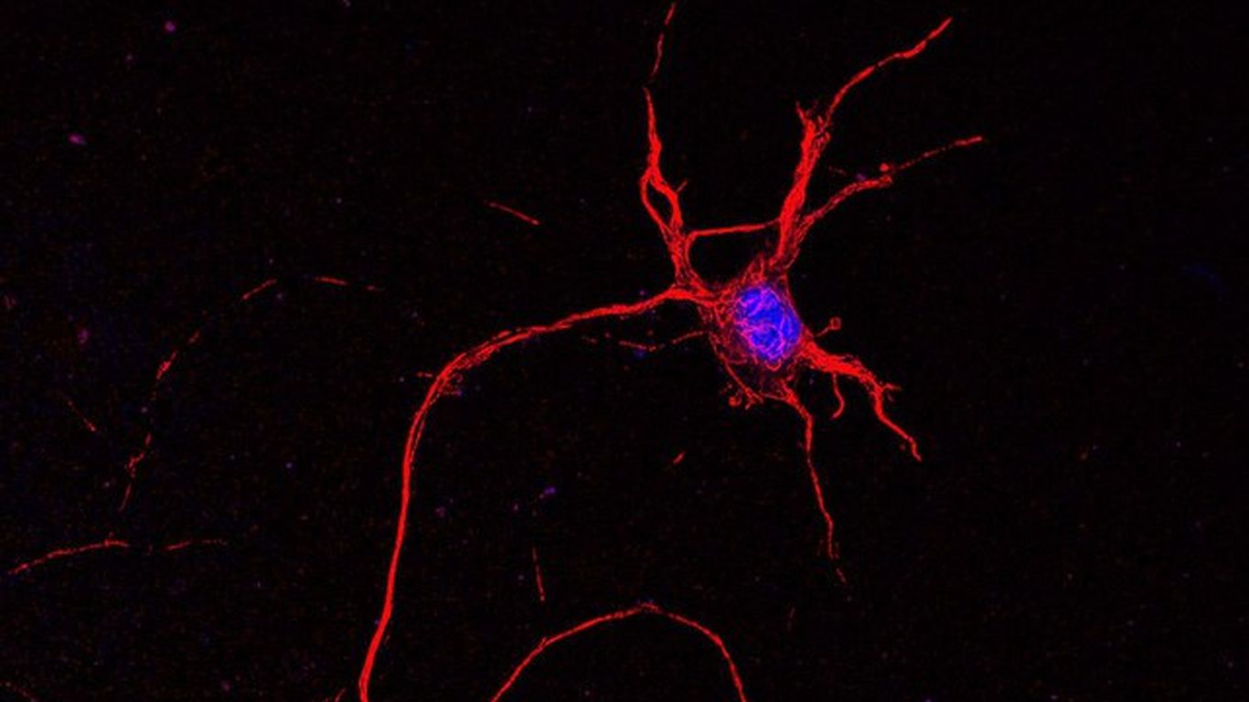 How the brain gets an itch