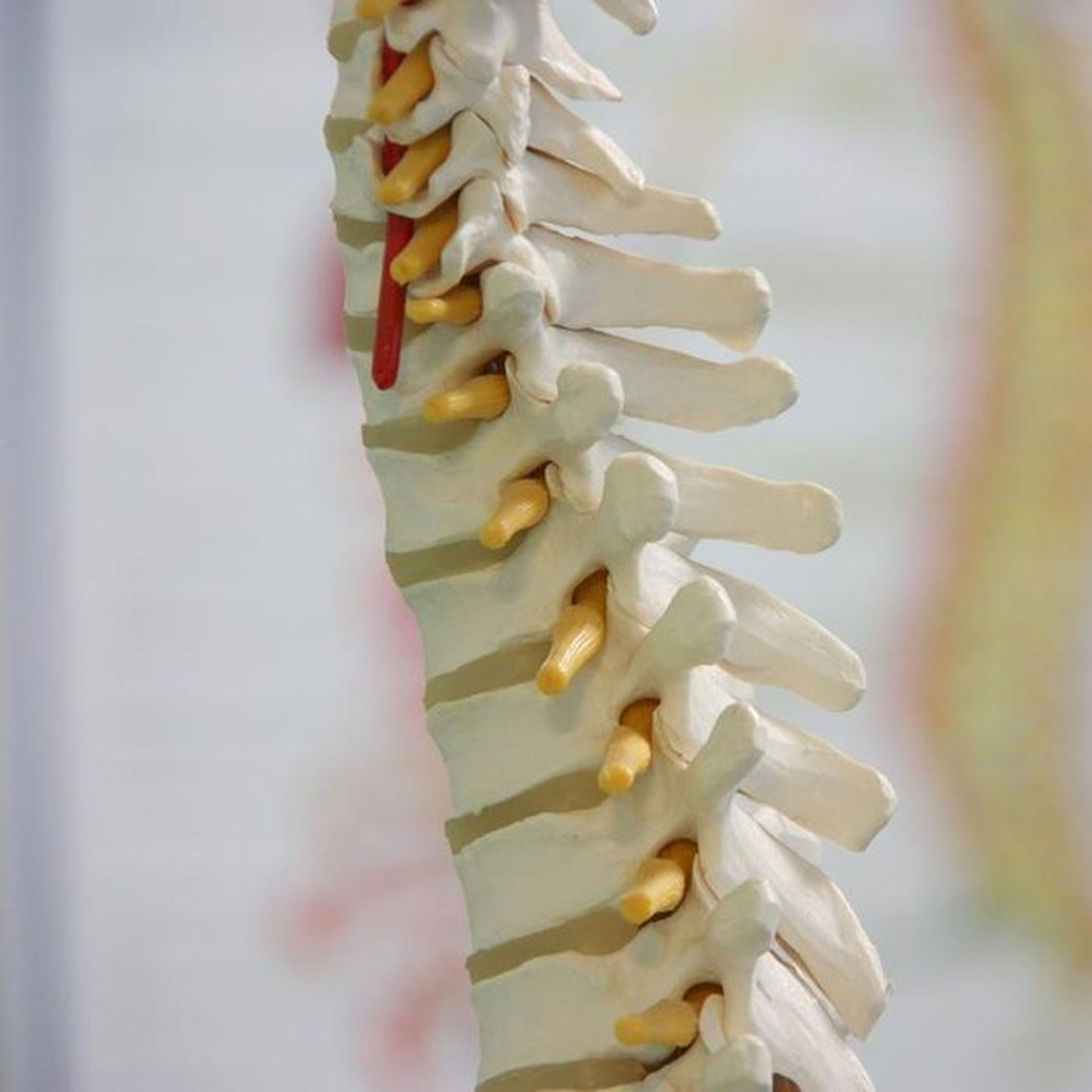 Biomet Recall