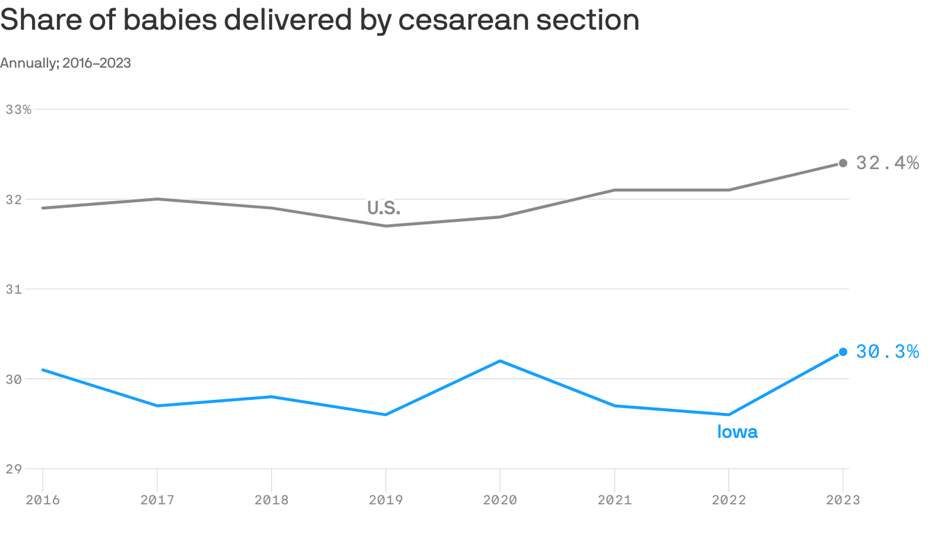Iowa's C-section rates rise - Axios Des Moines
