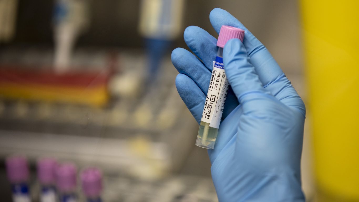 U.S. expands monkeypox testing to better track scope of outbreak