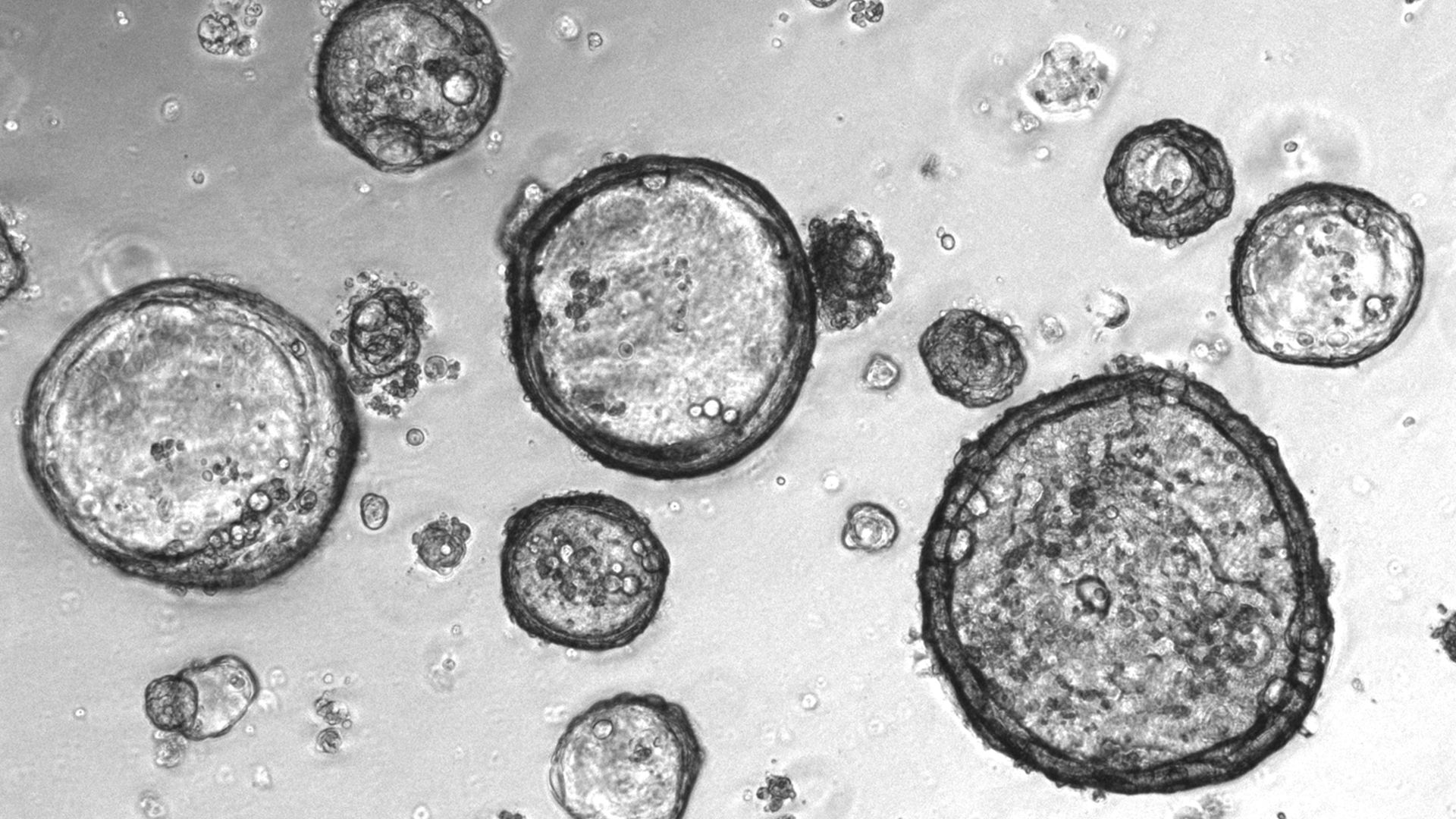 Mini lab-created organs successfully check cancer treatments