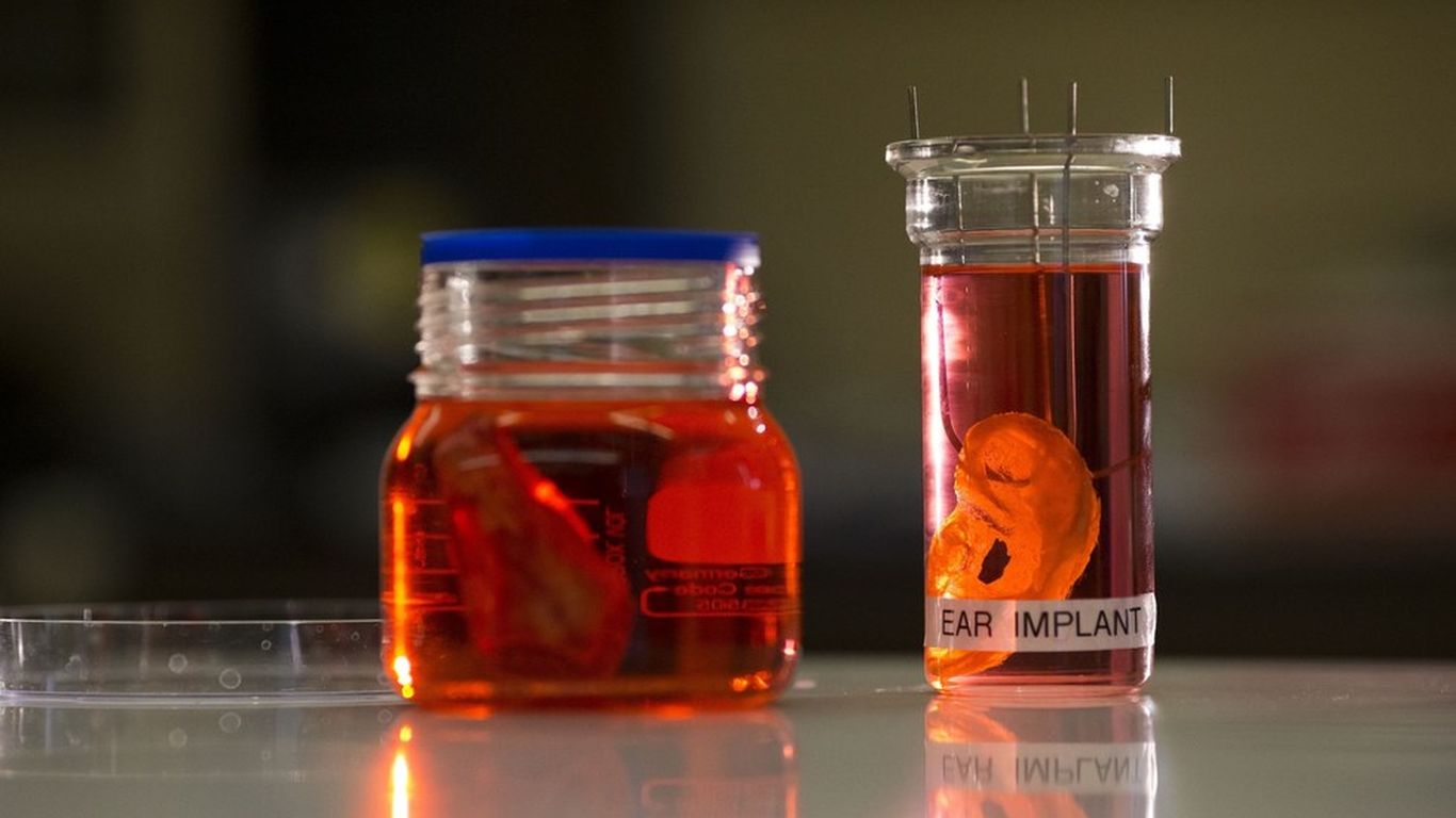 Scientists closer to growing human organs in animals