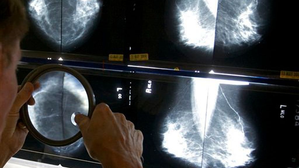 Scientists Identify New Gene Variations Linked To Breast Cancer