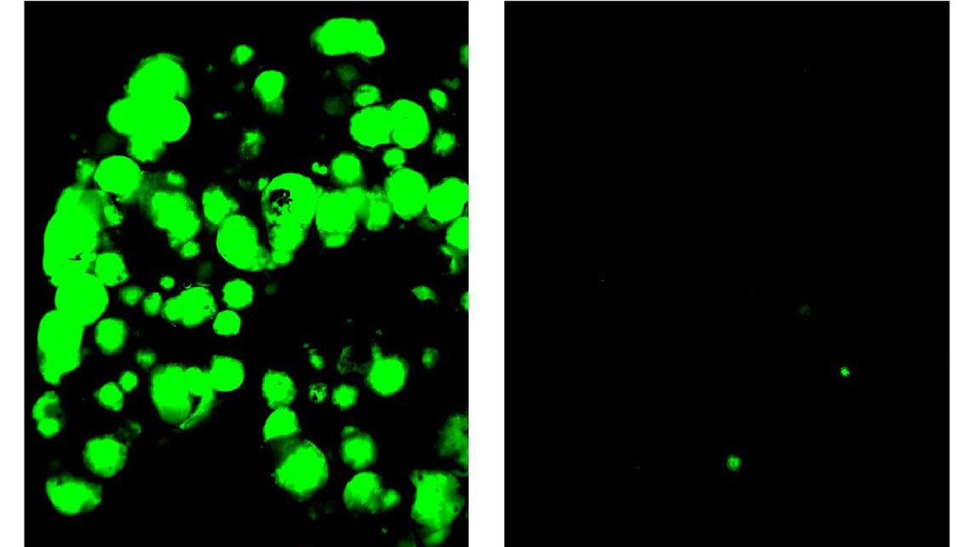 Trying to prevent cancer cells from metastasizing