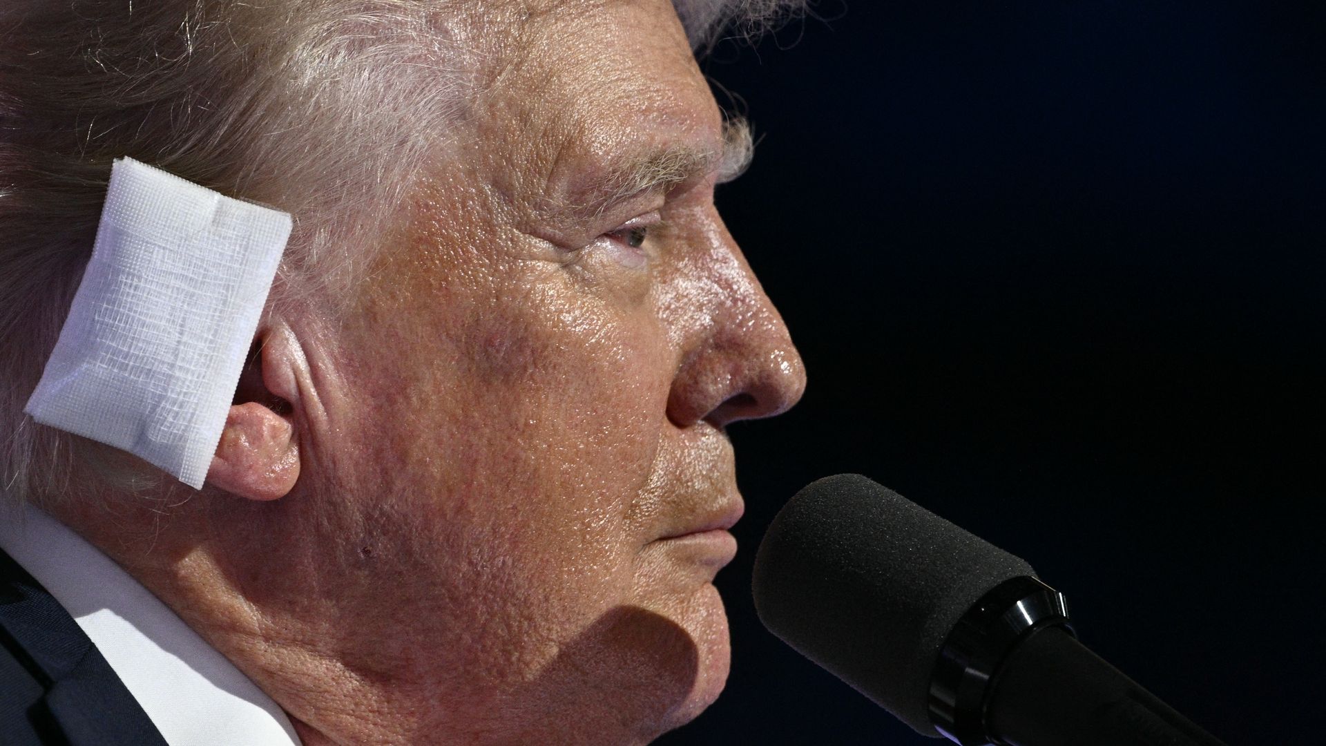 Trump shooting left 2cm wound in his ear, former physician says