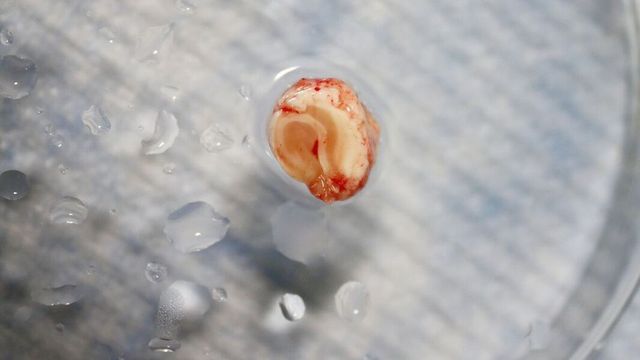 Scientists using living brain tissue to map human brain