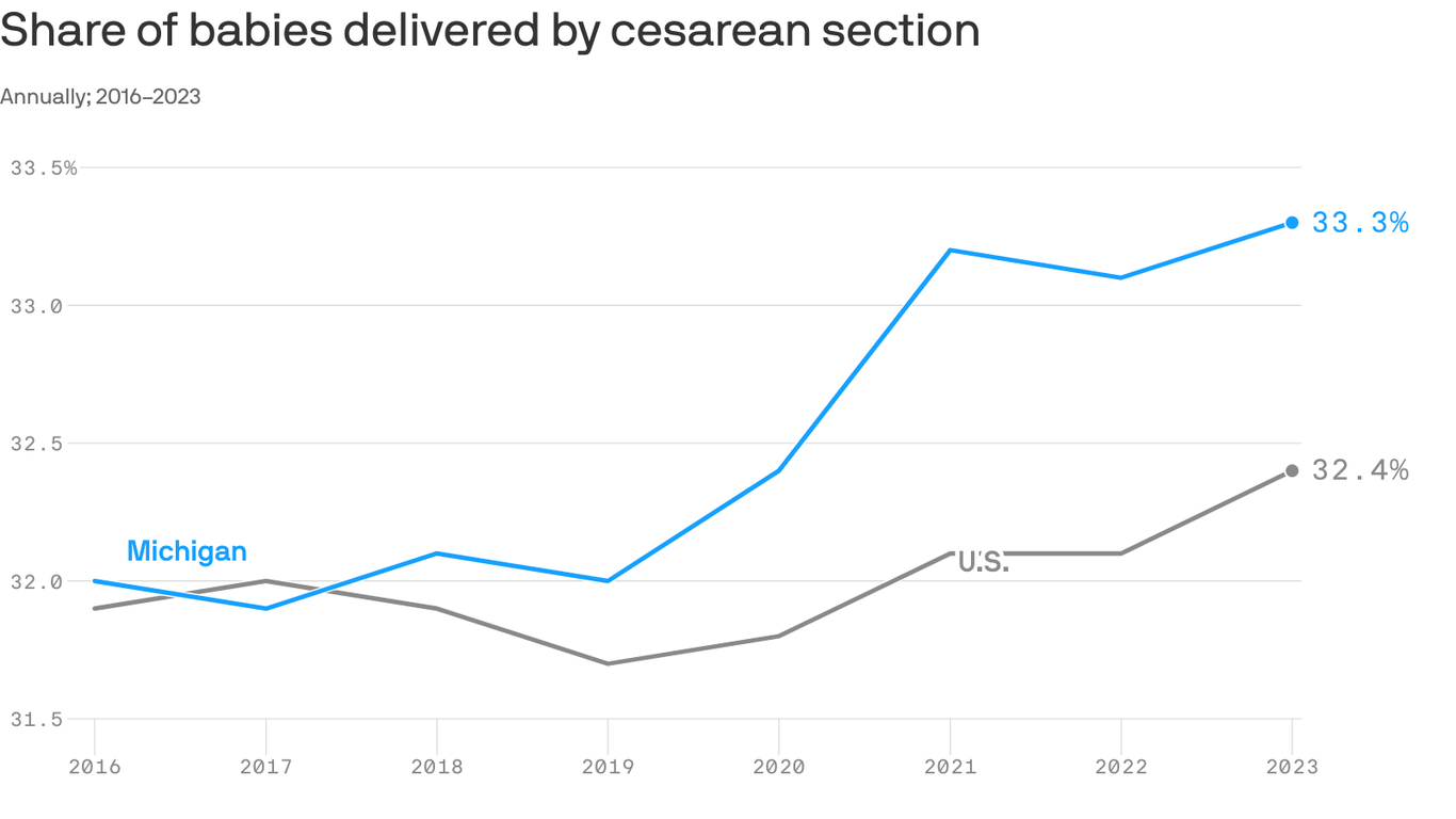 Michigan C-section rate higher than national average - Axios Detroit