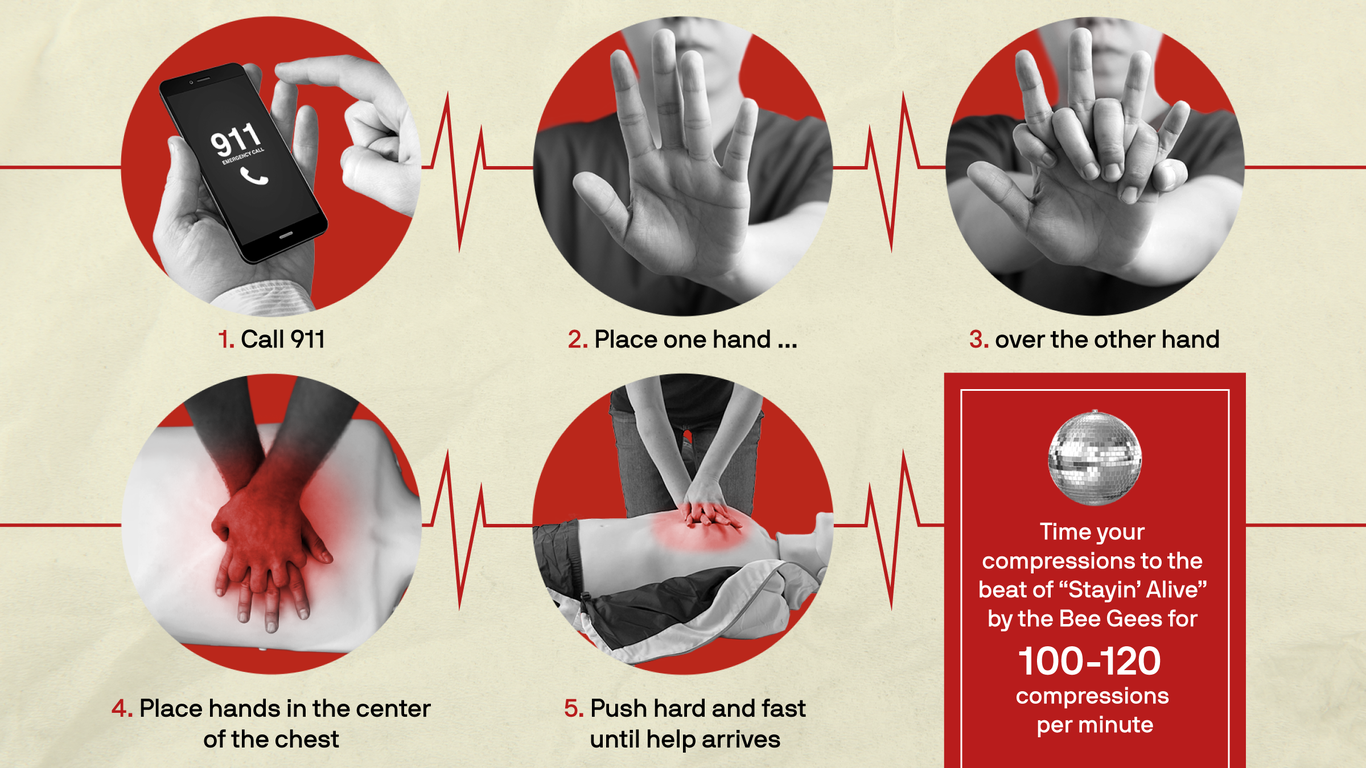 After Bronny James’ cardiac arrest, what to know about life-saving CPR