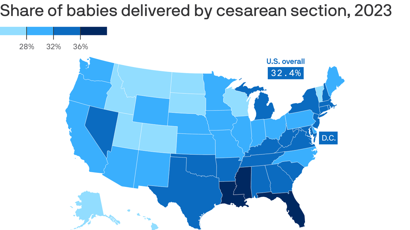 C-sections in the U.S.: Why the rate increased, again