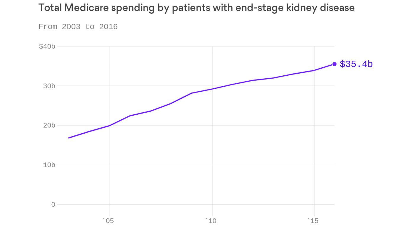 Kidney failure treatment costs Medicare $35 billion
