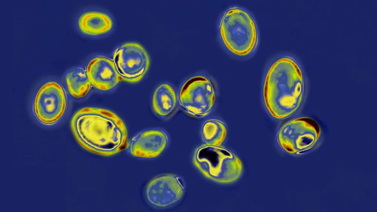 Candida auris: What to know about the fungus outbreak in Washington ...